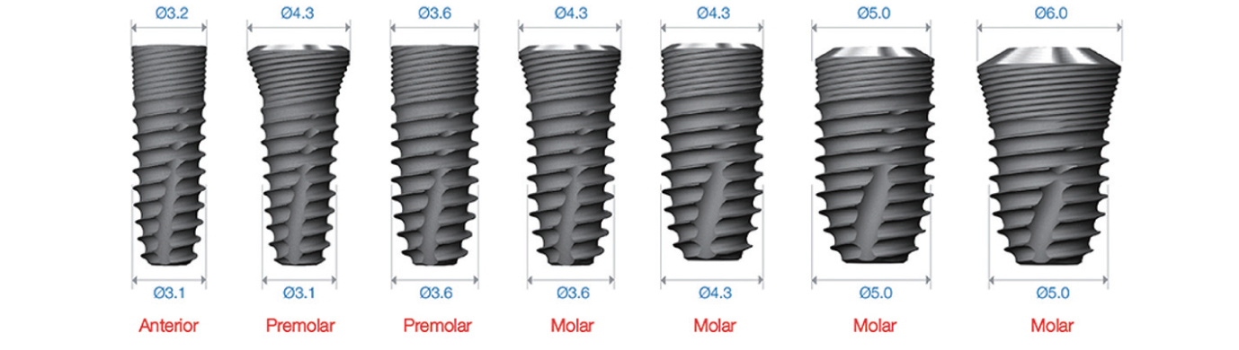 덴티움 임플란트 종류별 가격 및 오스템과의 차이점 비교